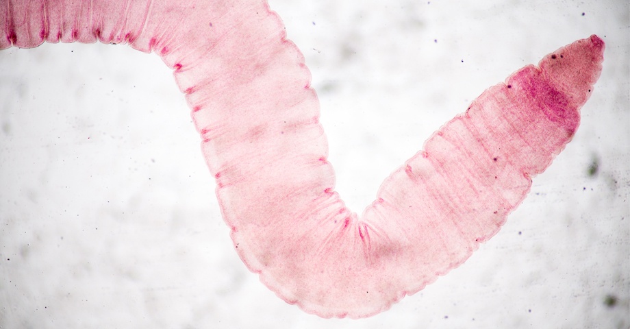On tapeworms and employee health